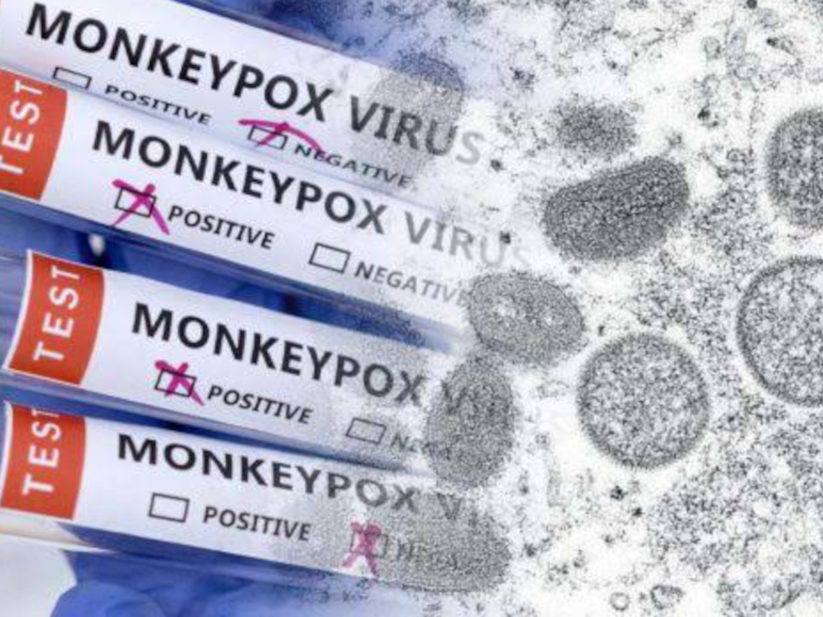 Officials backtrack on school monkeypox case - Scrolla.Africa