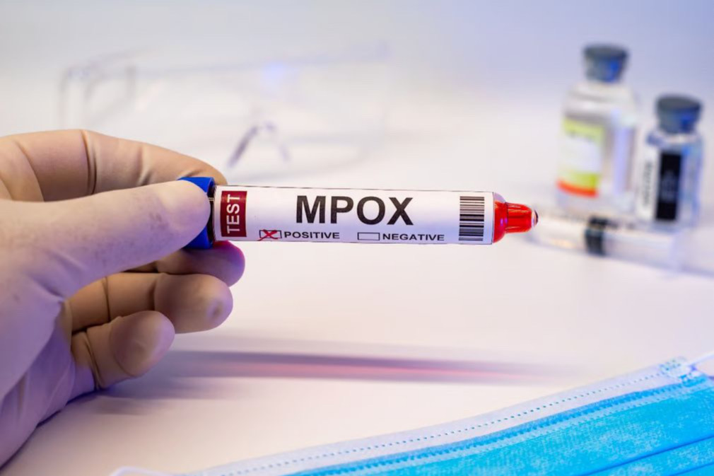 World news bites: WHO declares mpox a global health emergency - Scrolla ...