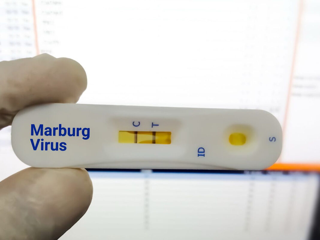 World news bites: ‘Marburg virus under control’ – Rwanda | Scrolla.Africa